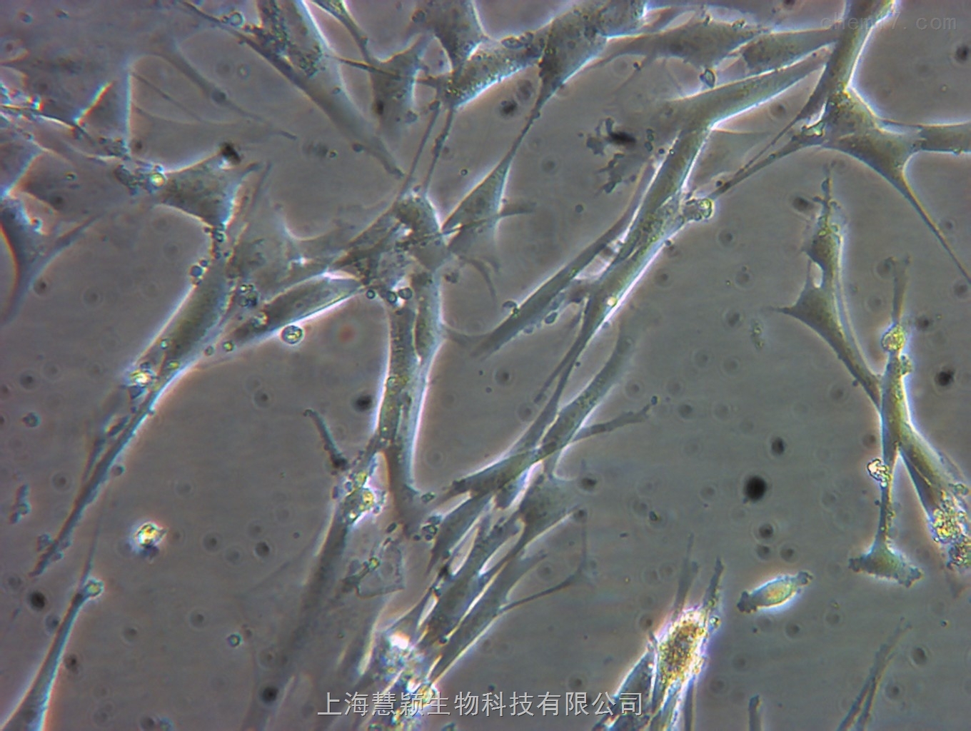 MRC-5细胞价格人胚肺成纤维细胞形态_人正常细胞株-上海慧颖生物科技有限公司